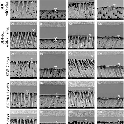 Representative Sem Micrographs Of Hybrid Layer Characterization Areas Download Scientific