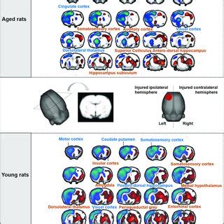 Sensorimotor Brain Regions Of Aged And Young Rat Significant Metabolism