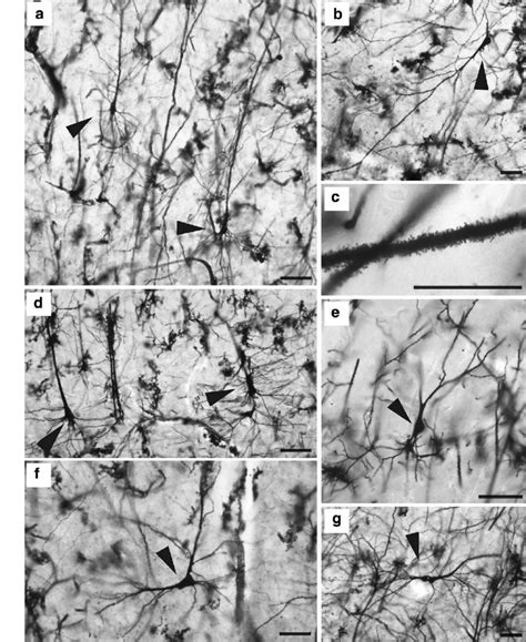 Photomicrographs Of Golgi Impregnated Neurons In Visual Ac And Motor