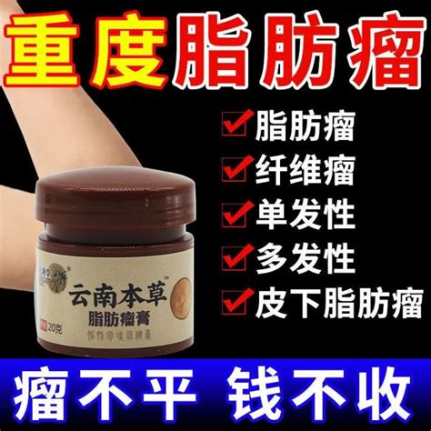 Lipoma 101 Healing Designed 36 Kinds Of Multiple Elimination Lipoma