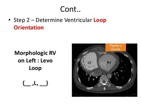 Sequential Segmental Analysis Of Heart