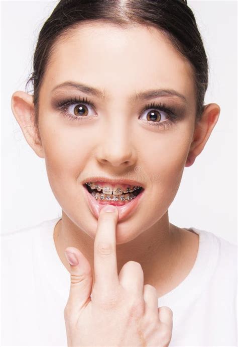 Beautiful Young Girl With Brace Stock Image Image Of Teenager Tasty 86413305