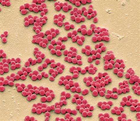 Group A Streptococcus Bacteria Sem Stock Image C057 3766 Science Photo Library