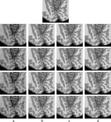 Comparing The Segmentation Results Of Simulated T1 Weighted Mr Slice 68