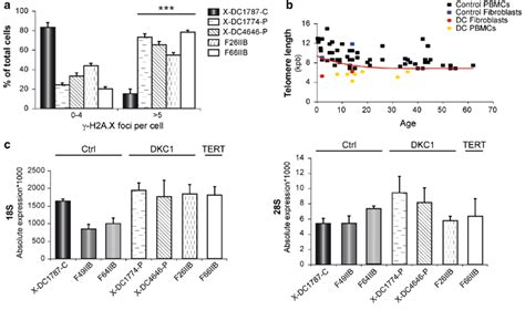 Increased C H2AX Foci Per Cell In X DC And AD DC Patient S Fibroblasts
