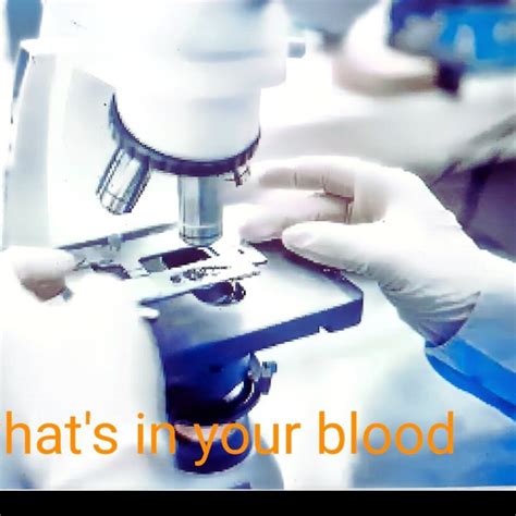 Lab Tests Results And Health Tips Explained Youtube