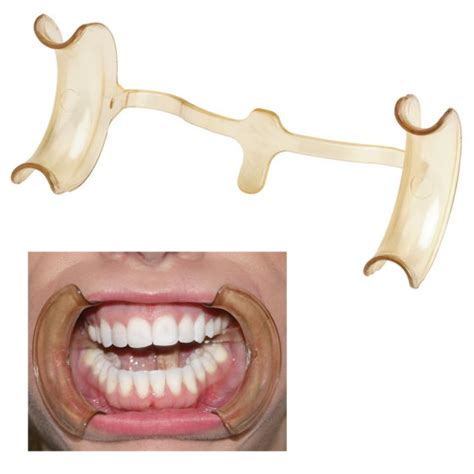 Intraoral Cheek Retractors Disposable Value Rx Inc