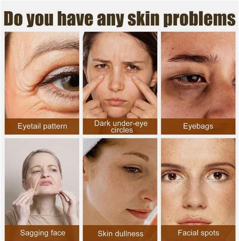 르제 코스메틱 매일 매일 피부톤업 각질제거 보습팩 나이트크림 멜라노필크림 모공은 쫀쫀하게 줄여주고 울퉁불퉁 피부는 매끈하게~스트레스로 올라올 색소들을 막아줘요