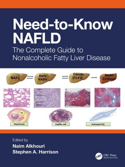 Book Review The Complete Guide To Nonalcoholic Fatty Liver Disease