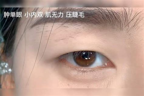 终于找到适合肿单眼的双眼皮贴法了！绝！单眼双眼皮