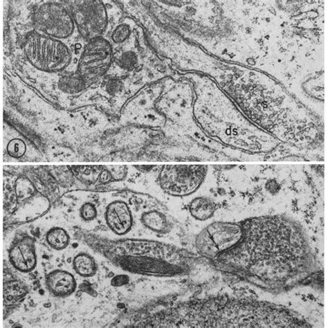 Pdf Cerebellar Granule Cells In Vitro