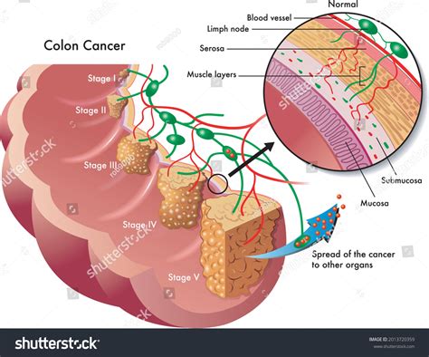 Polyp Stage 114 Images Photos Et Images Vectorielles De Stock