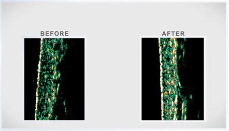 The Science Behind Collagen Collagen Lift Paris ZA