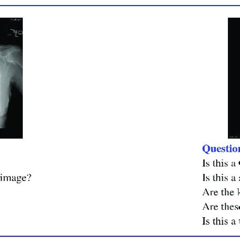 Overview Of Vqgrad A Visual Question Generation System For Radiology Download Scientific