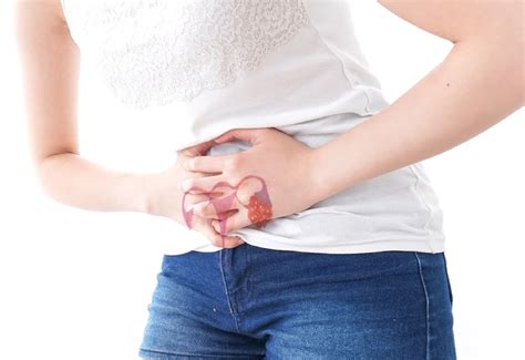 What Is Cervicitis Symptoms Causes Treatment Medical Journey