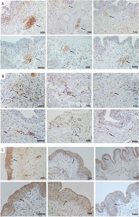 Immunohistochemical Analysis Of The Bladder Tissues Effects Of