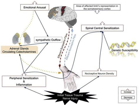 Complex Regional Pain Syndrome In The Foot Physiopedia