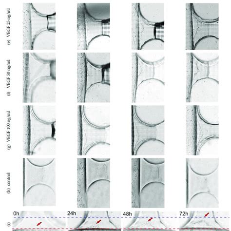 Structure Of Microvessel Created By Viscous Finger Patterning A