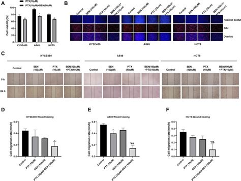 Benserazide A Cystathionine Beta Synthase Cbs Inhibitor Potentially