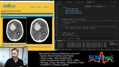 exploring image feature detection fast harris and shi tomasi
