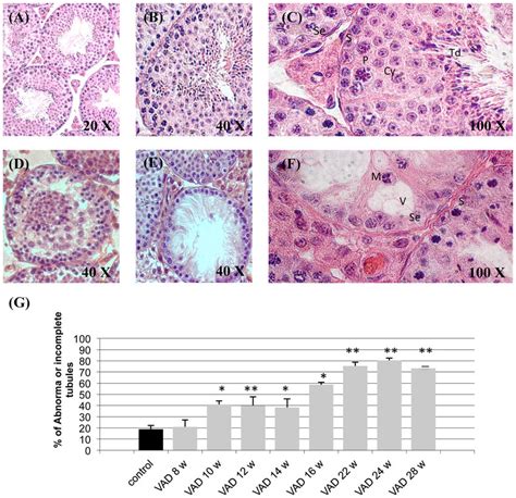 Effect Of Vad On Mouse Testicular Morphology As A Function Of Time