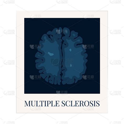 Mri