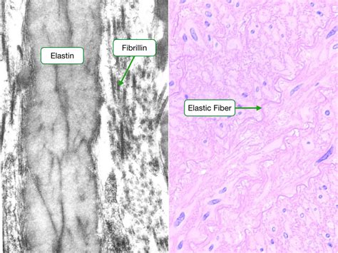 Elastic Fibers