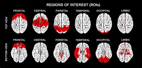 Frontiers Classification Of Healthy Subjects And Alzheimers Disease