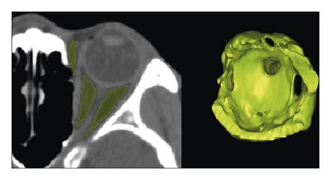 Axial Ct Slices With The Highlighted Segmented Tissues And The Download Scientific Diagram