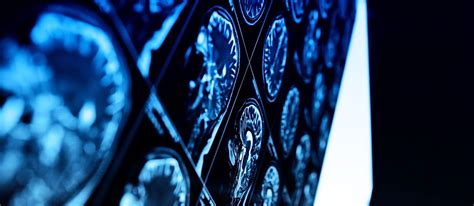 Μαγνητική Τομογραφία Προηγμένη Απεικόνιση