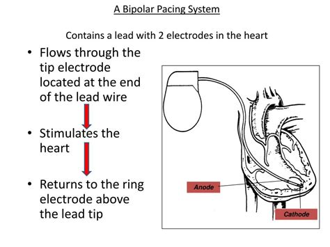 Ppt Basics Of Pacemaker Powerpoint Presentation Free Download Id