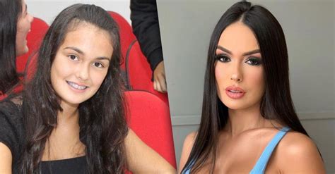 Bbb23 Conheça O Antes E O Depois Dos Participantes ~ Votalhada