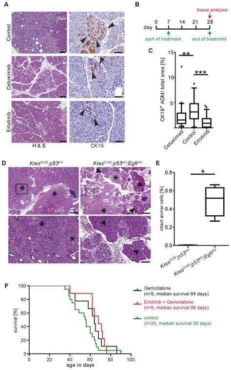 Egf Receptor Is Required For Kras Induced Pancreatic Tumorigenesis Pmc