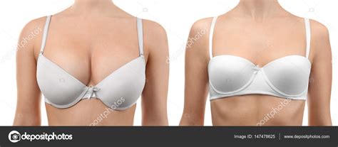 Plastic Surgery Concept Stock Photo Belchonock