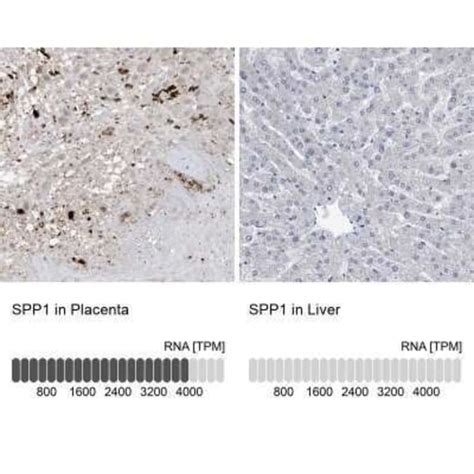 Osteopontin OPN Antibody Novus Biologicals 25 μL Unconjugated