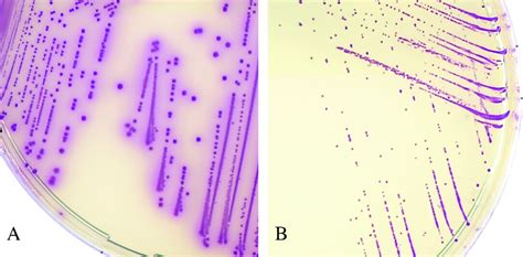 Comparison Of Chromagar Salmonella Medium And Hektoen Enteric Agar For