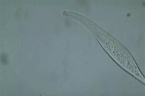 【收藏】24种污水处理微生物菌相及指导意义 中国水网