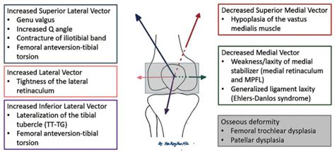 Do You Know That Risk Factors And Treatment Of Patellofemoral Joint