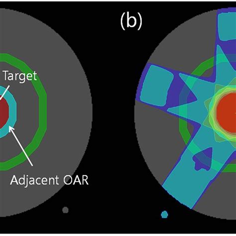 Axial Slices Of The Arccheck Ct Phantom With The Target Adjacent Organ