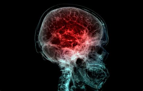 人脑“高级区”最易衰老—新闻—科学网
