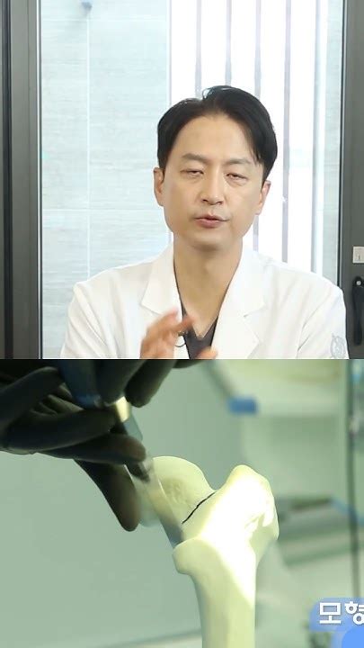 고관절 인공관절 무게가 궁금해요 Shorts 인공고관절 인공관절 인공관절수술 Youtube
