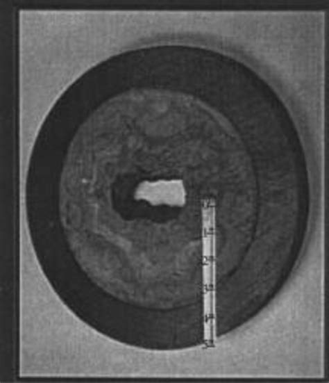 Example Of A Pipeline Blockage From Singh Et Al Download Scientific Diagram