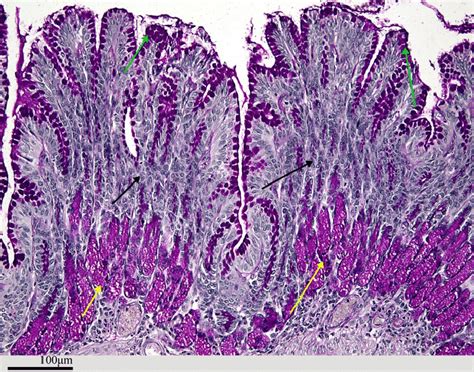 Pyloric Region