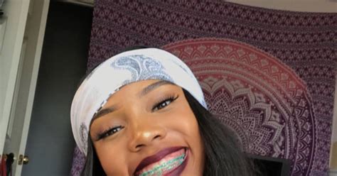 Cute Braces Colors For Light Skins Find Property To Rent
