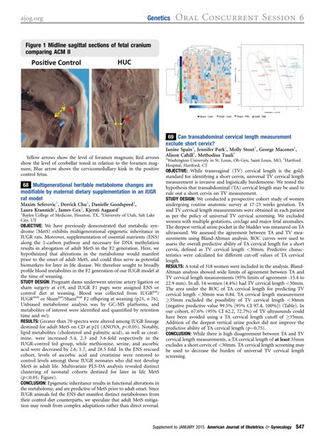 Pdf 69 Can Transabdominal Cervical Length Measurement Exclude Short