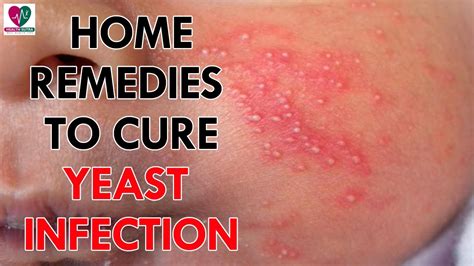 Natural Home Remedies Yeast Infection Health Sutra Youtube