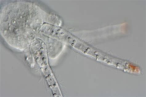An Actinula Larva From A Jellyfish Jellyfish Larvae