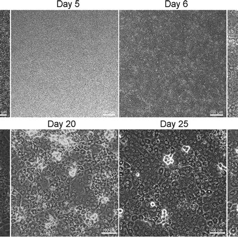 Differentiation Of Hpscs Into Keratinocytes Bright Field Images Showing