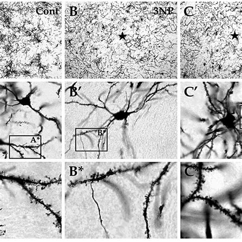 Effect Of 3np On Dendritic Spines Of Striatal Neurons And The Download Scientific Diagram