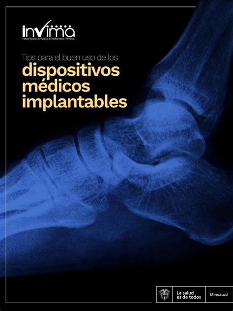 Dispositivos Medicos Implantables Pdf